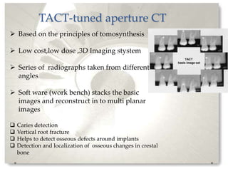 Advanced radiographic aids in periodontics | PPTX