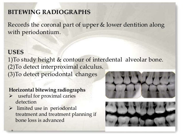 Advanced radiographic aids in periodontics