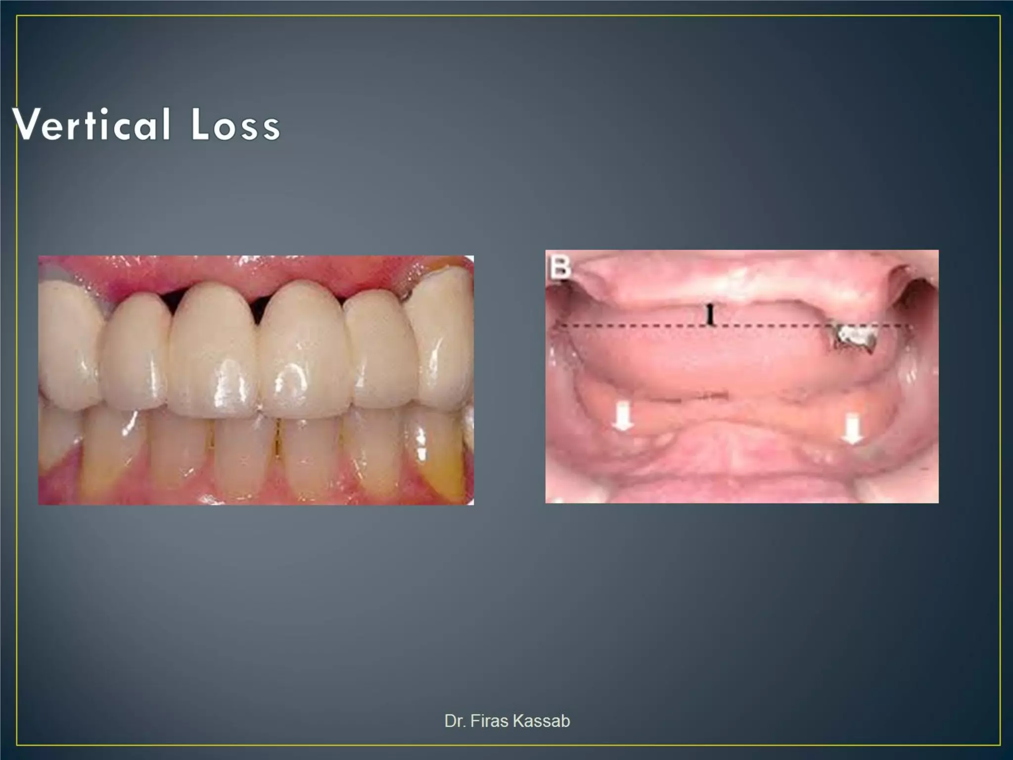 Advance bone preservation and regeneration | PDF