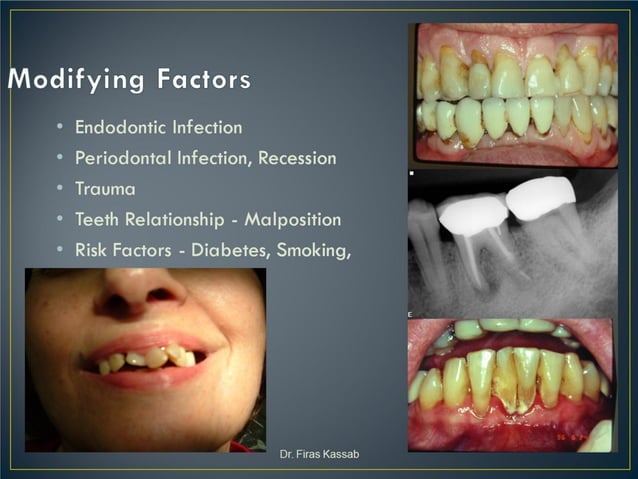 Advance bone preservation and regeneration | PDF