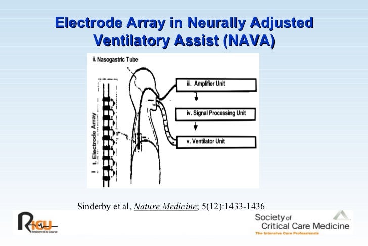 Advanced Mechanical Ventilation