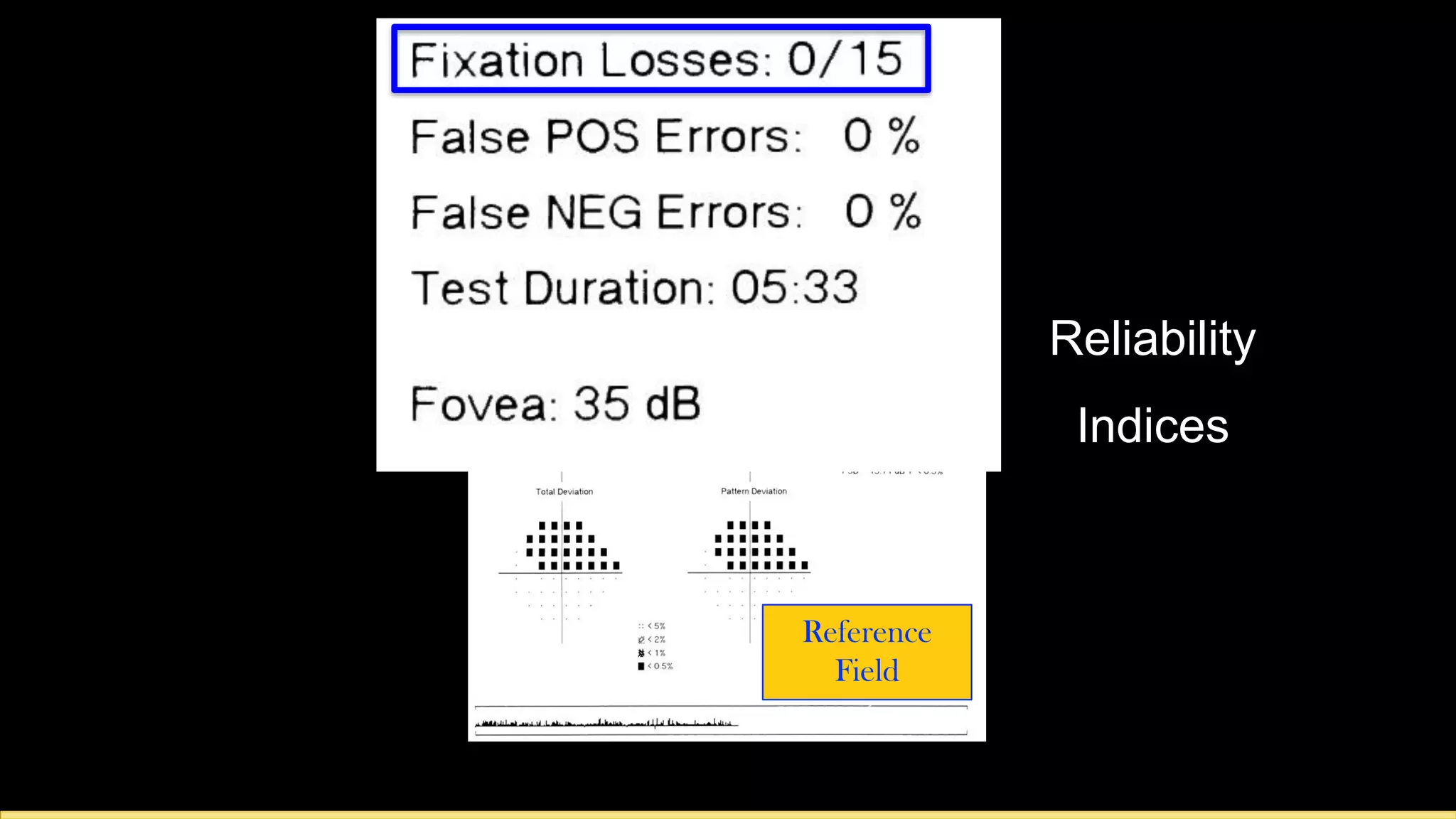 Advanced perimetry-interpretation | PDF
