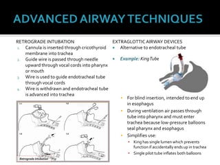 Advanced airway | PPTX