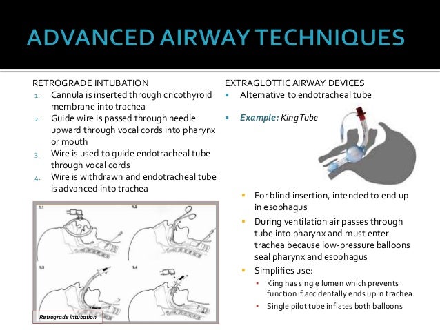 Advanced airway