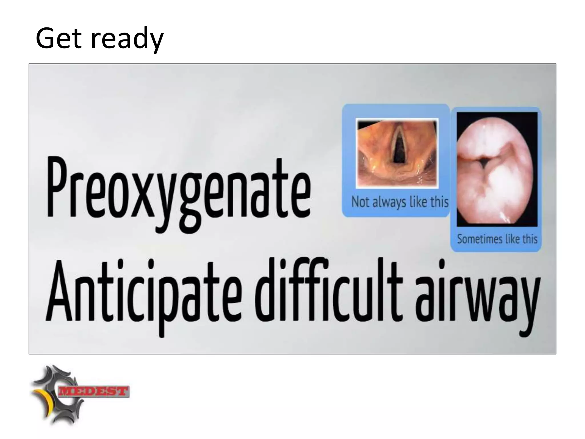 Advanced Airway Management | PPT