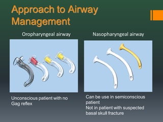 Advanced Airway Management.pdf