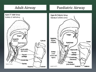 Advanced Airway Management.pdf