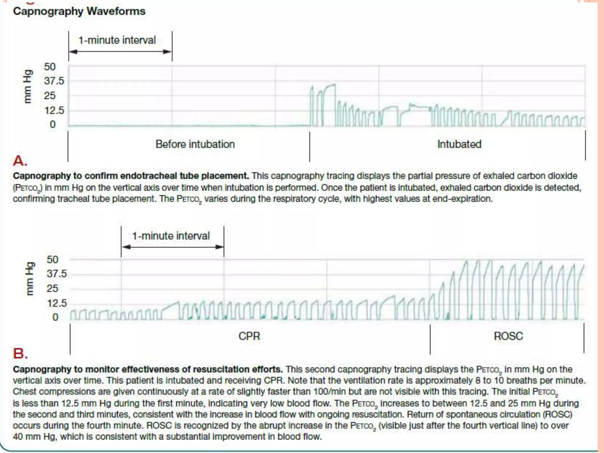 Advanced cardiac life support(acls) | PPTX