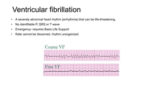 ADVANCED CARDIAC LIFE SUPPORT (ACLS).pdf