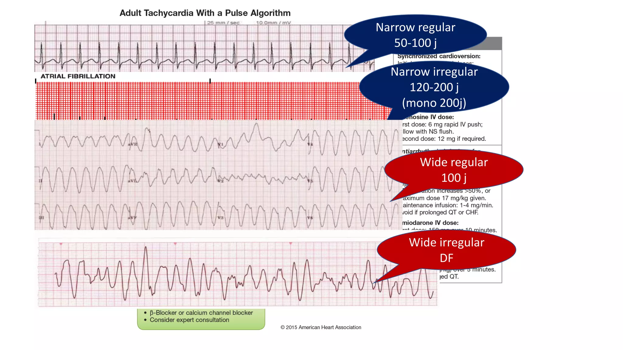 Advanced Cardiovascular Life Support (ACLS).pptx