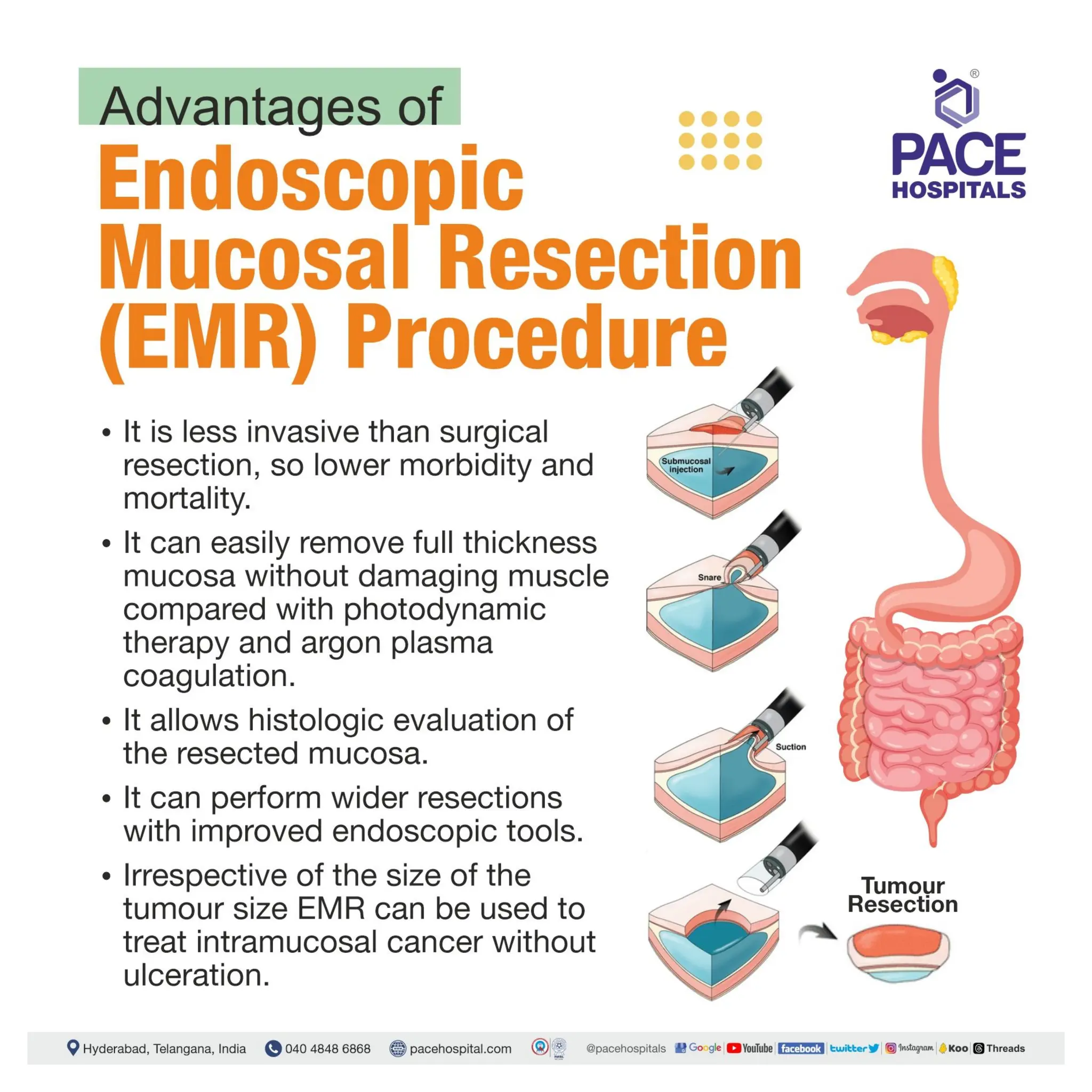 Endoscopic Mucosal Resection (EMR) - Procedure Indications & Cost | PDF