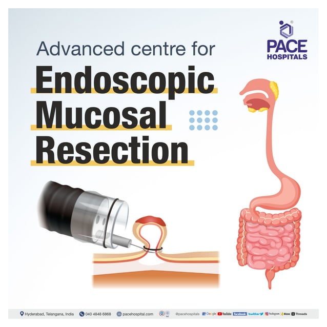 Endoscopic Mucosal Resection (EMR) - Procedure Indications & Cost | PDF