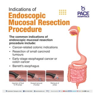 Endoscopic Mucosal Resection (EMR) - Procedure Indications & Cost | PDF