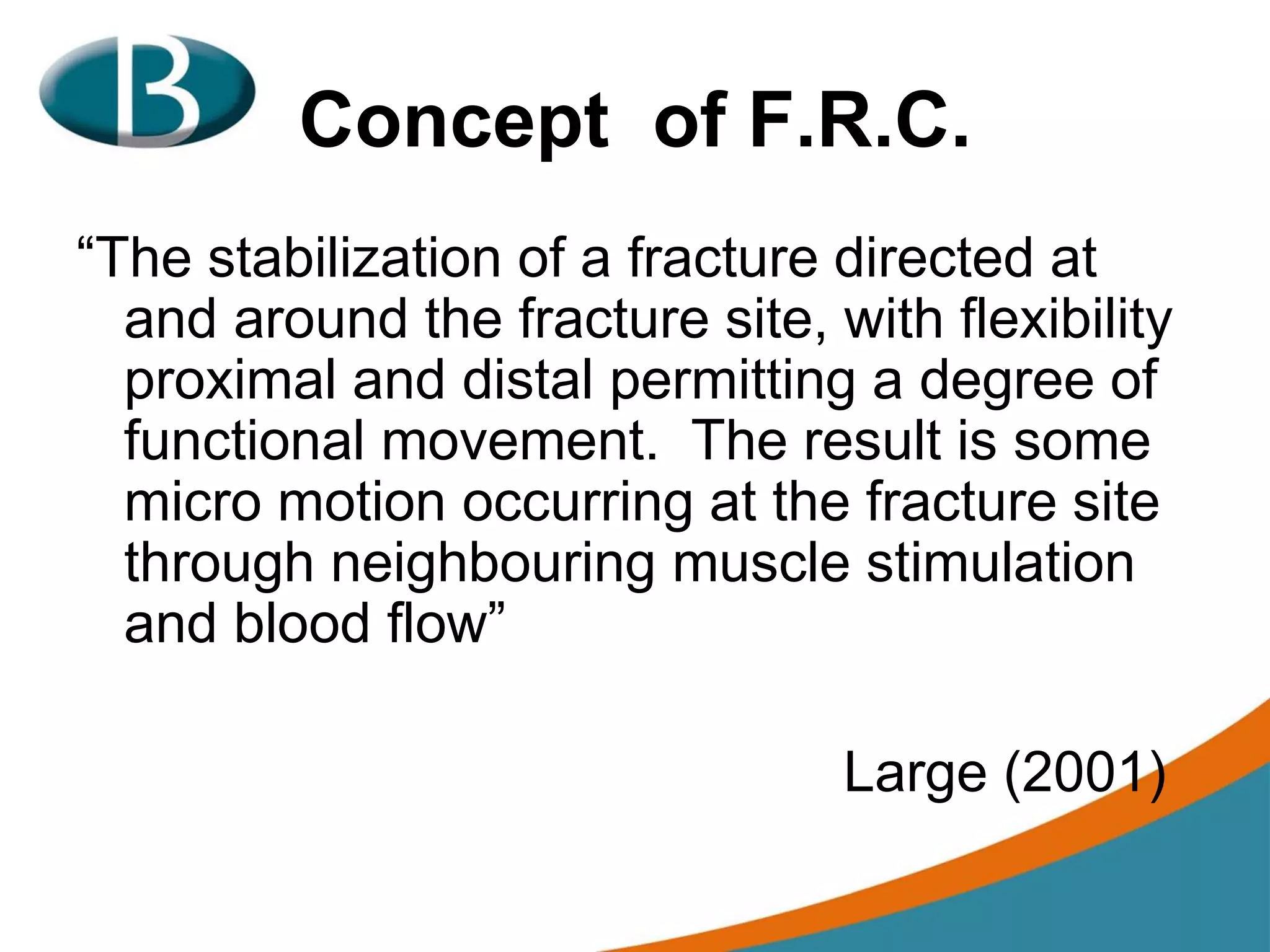Advanced complex casting, bracing and introduction to FRC | PDF