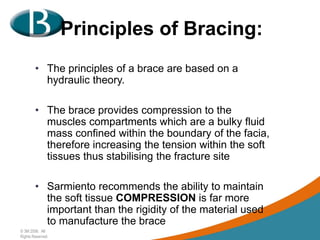 Advanced complex casting, bracing and introduction to FRC | PDF