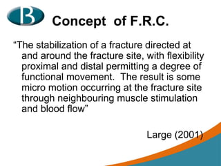 Advanced complex casting, bracing and introduction to FRC | PDF