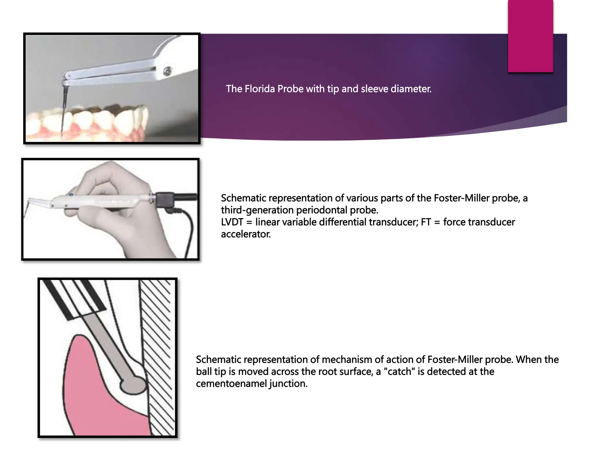 advanced diagnostic aids in periodontics | PPTX