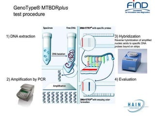 Advanced diagnostics of tuberculosis 21 3-15 | PPTX
