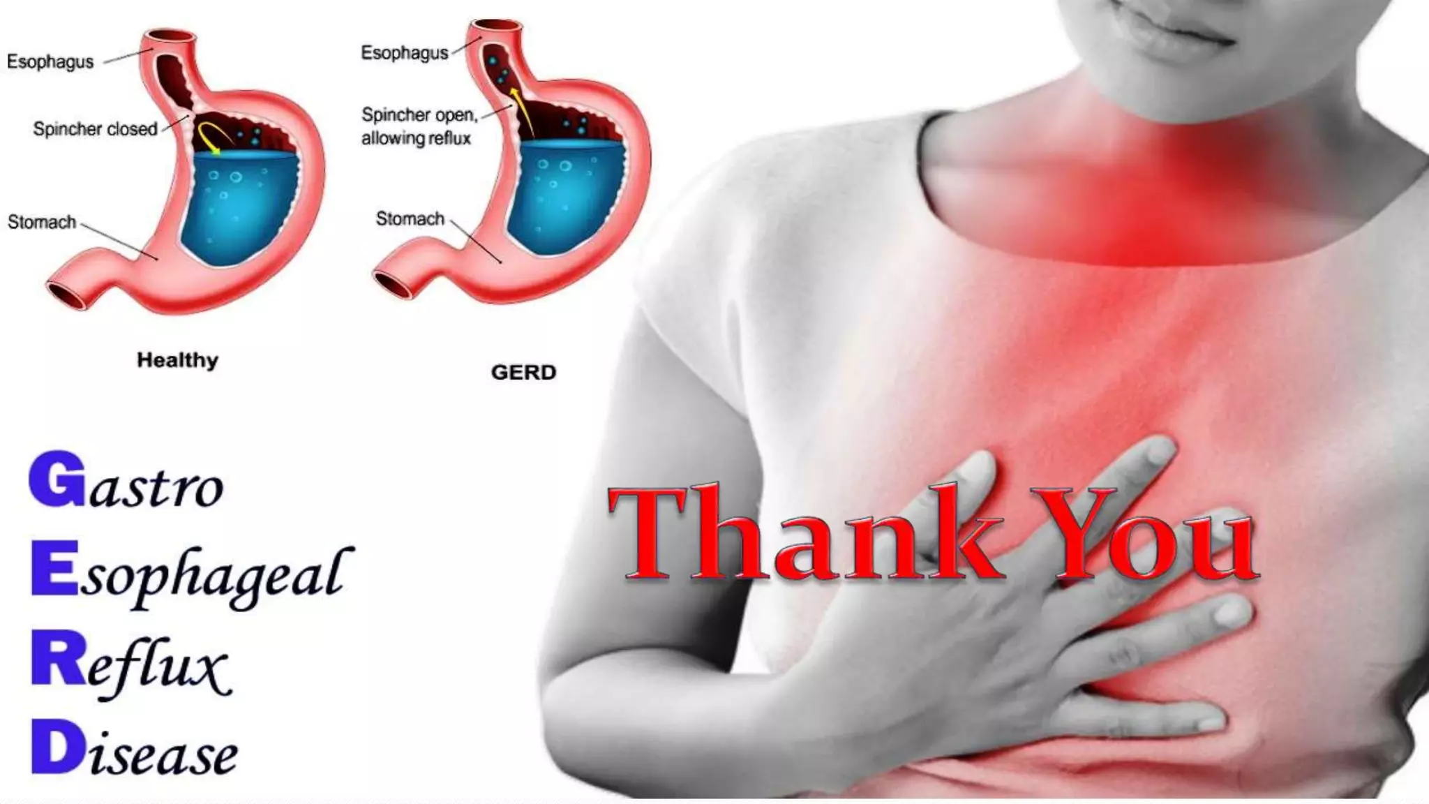 Advanced diagnostic strategies in GERD | PPTX
