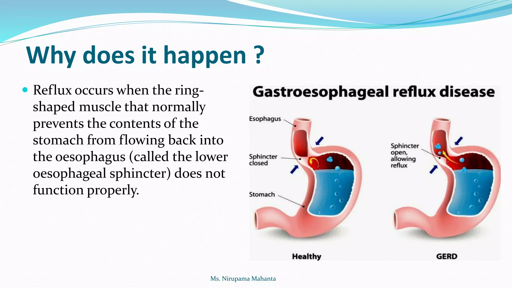 Advanced diagnostic strategies in GERD | PPTX