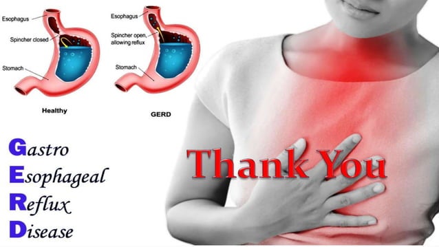 Advanced diagnostic strategies in GERD | PPTX