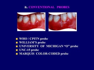 ADVANCED DIAGNOSTIC TECHNIQUES.ppt