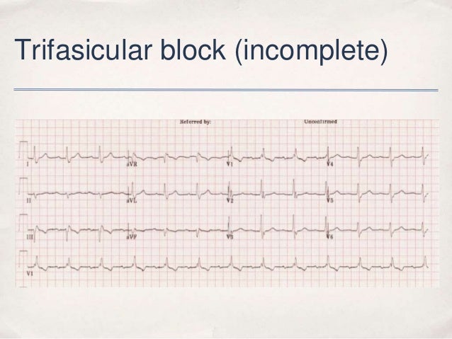 Advanced ecgs
