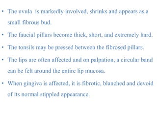 Advanced Treatment of Oral Submucous Fibrosis by Dr. Amit | PPT
