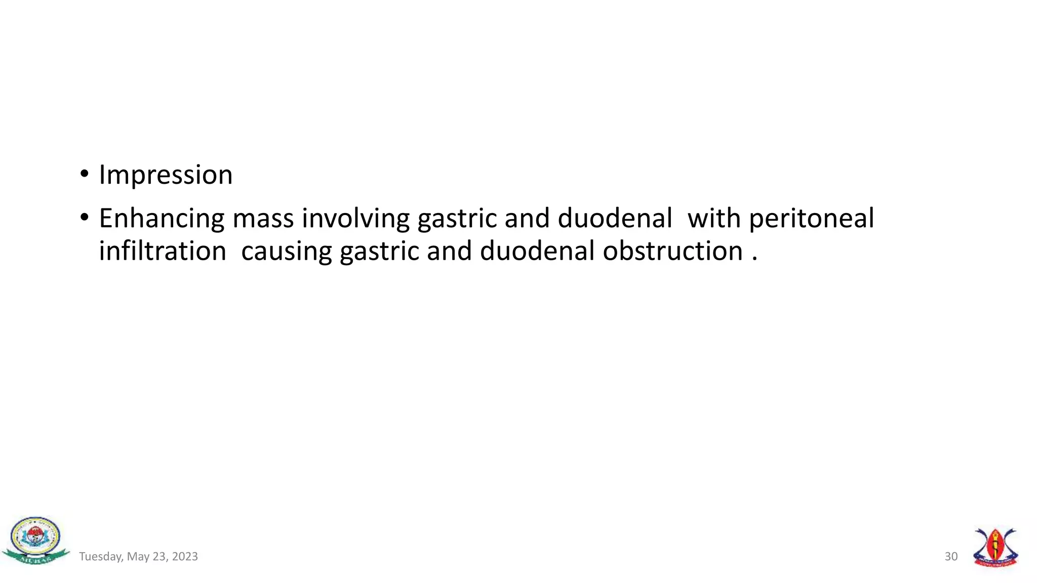 ADVANCED GASTRIC CANCER RX.pptx