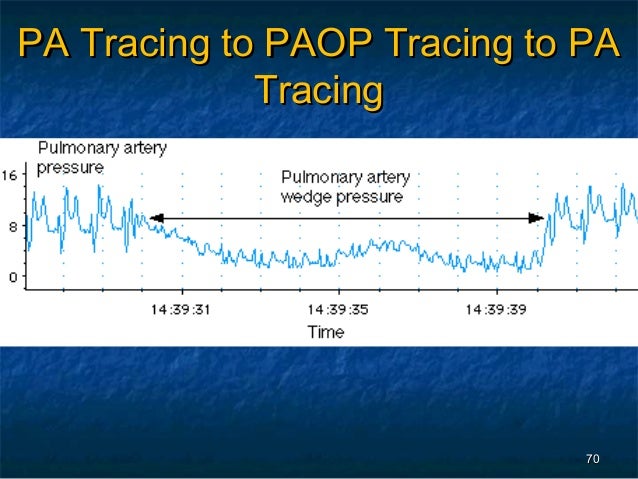 Advanced haemodynamics