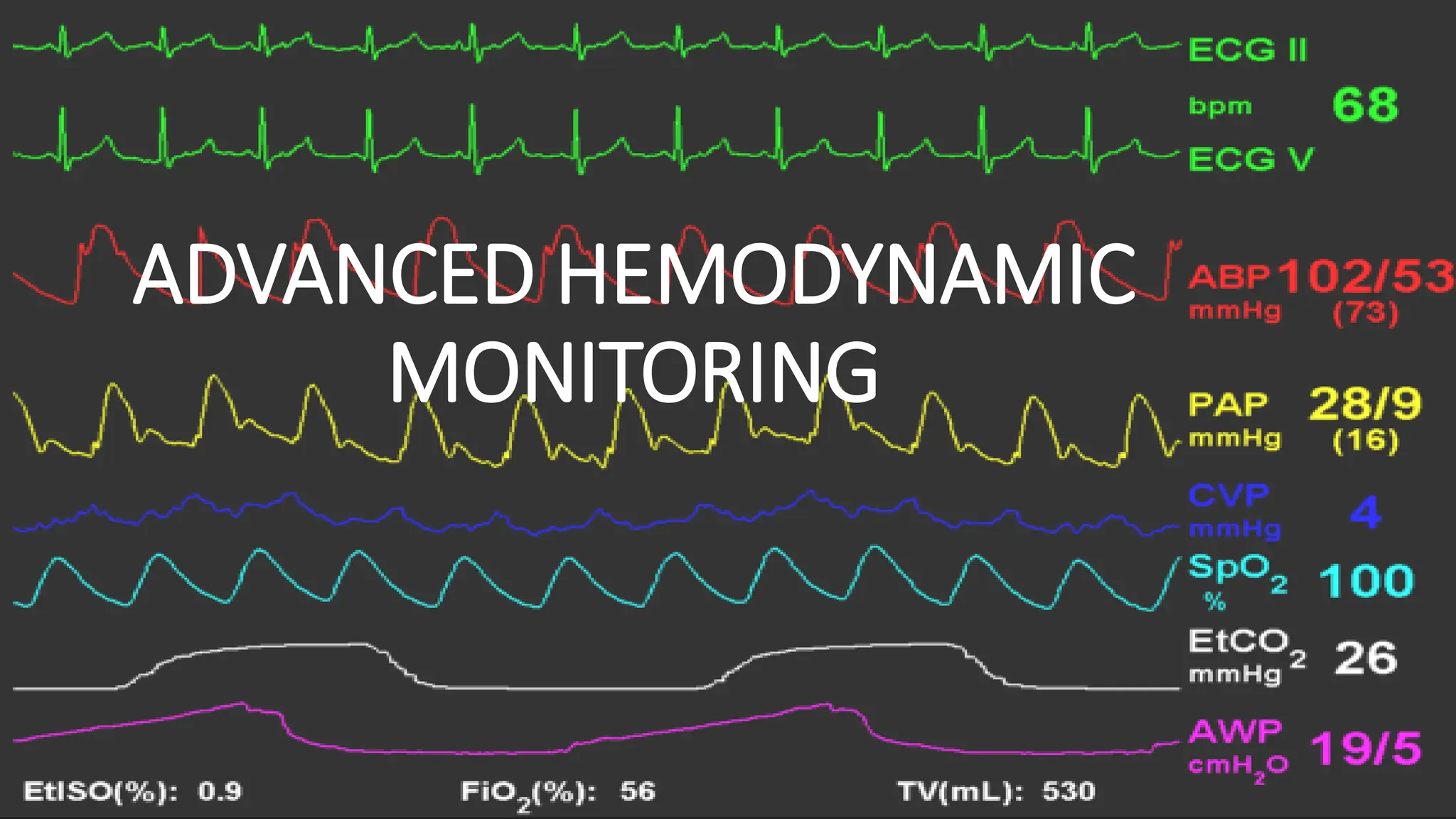 ADVANCED HEMODYNAMIC MONITORING IN CRITICAL CARE MEDICINE | PPTX