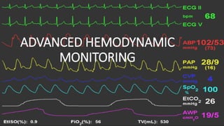 ADVANCED HEMODYNAMIC MONITORING IN CRITICAL CARE MEDICINE | PPTX