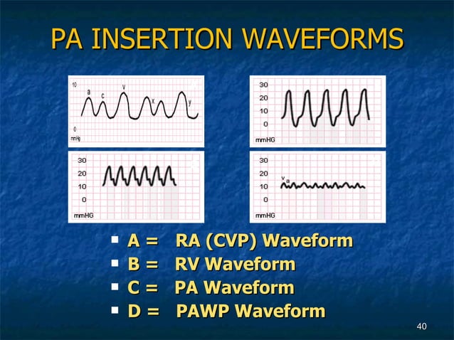 Advanced Hemodynamics | PPT