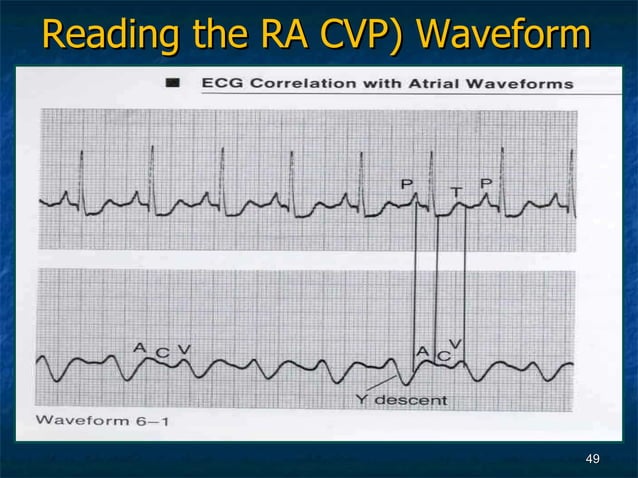 Advanced Hemodynamics | PPT