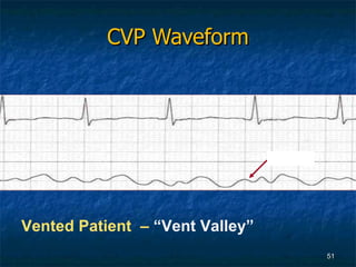 Advanced Hemodynamics | PPT