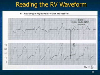 Advanced Hemodynamics | PPT