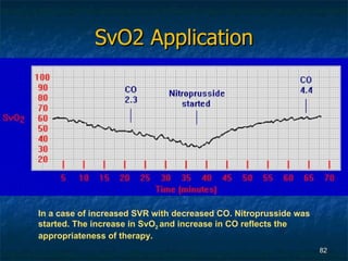Advanced Hemodynamics | PPT