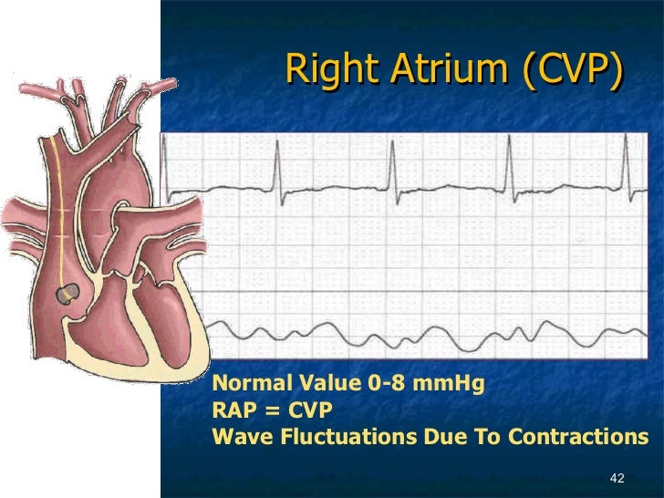 Advanced Hemodynamics