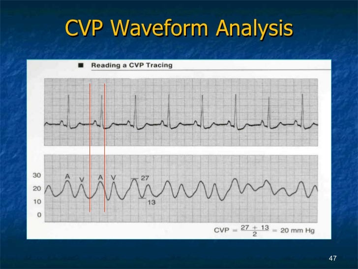 Advanced Hemodynamics