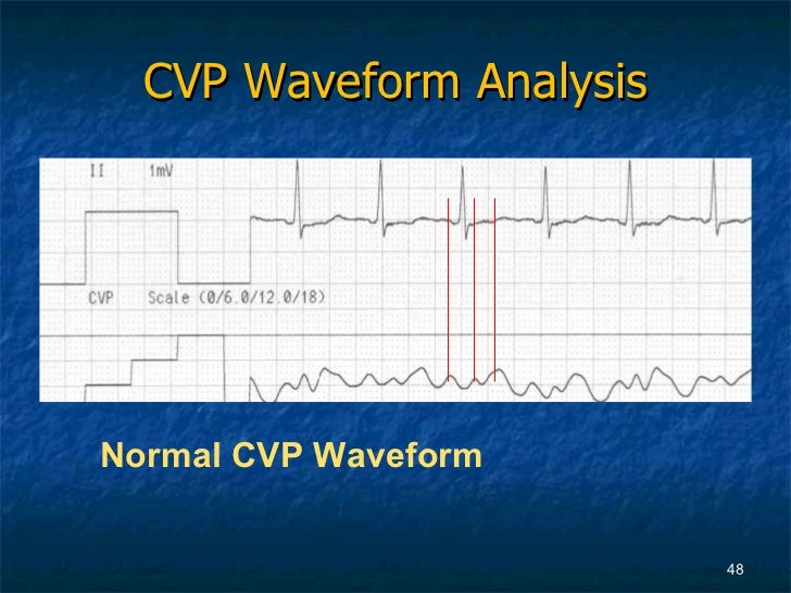 Advanced Hemodynamics