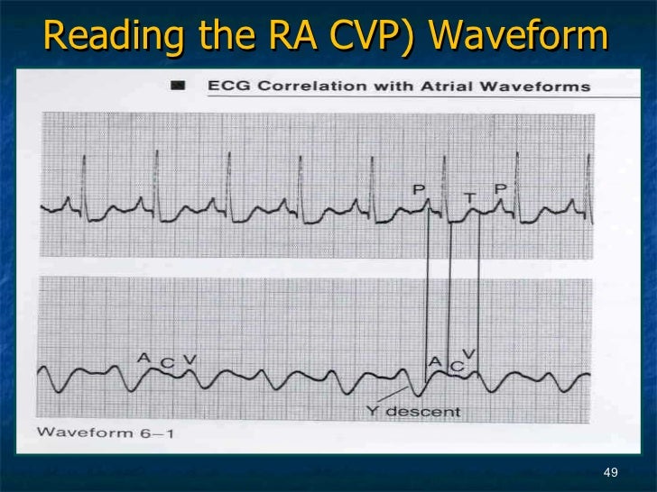 Advanced Hemodynamics