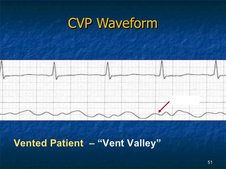 Advanced Hemodynamics