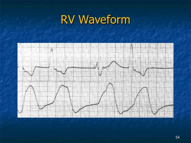 Advanced Hemodynamics