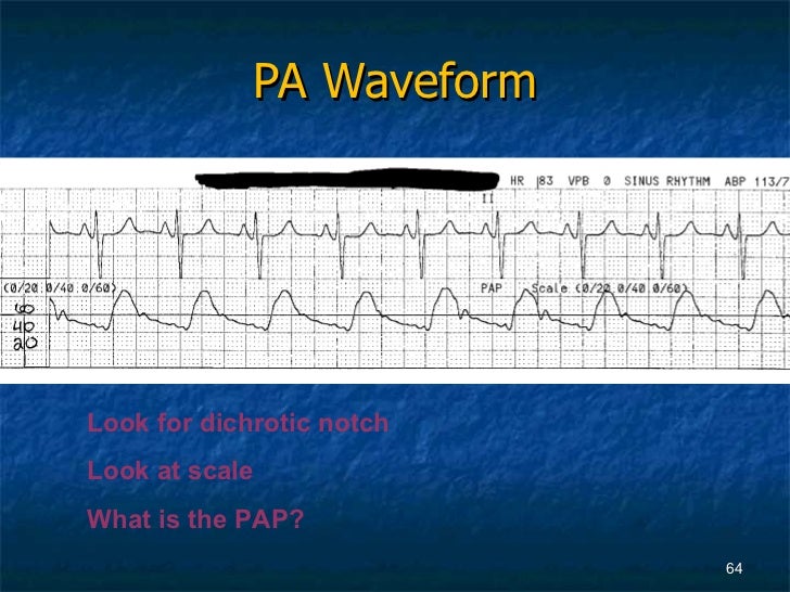 Advanced Hemodynamics