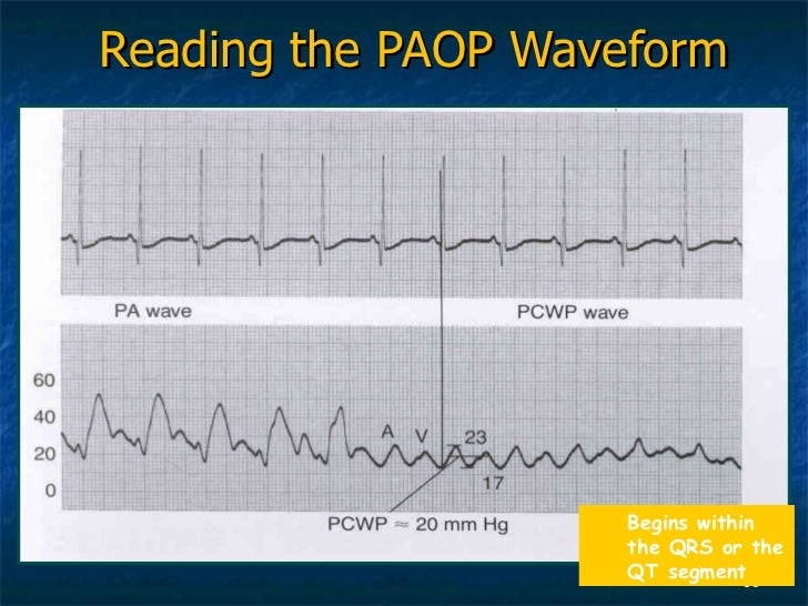 Advanced Hemodynamics