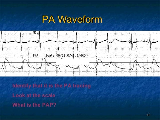 Advanced Hemodynamics