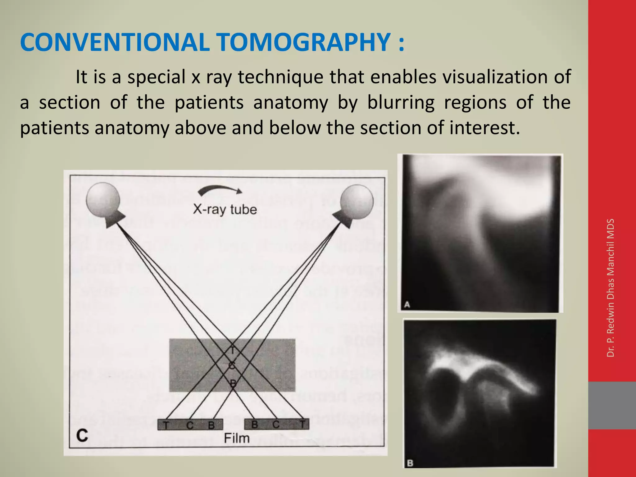 Advanced Imaging - Head and Neck | PPTX