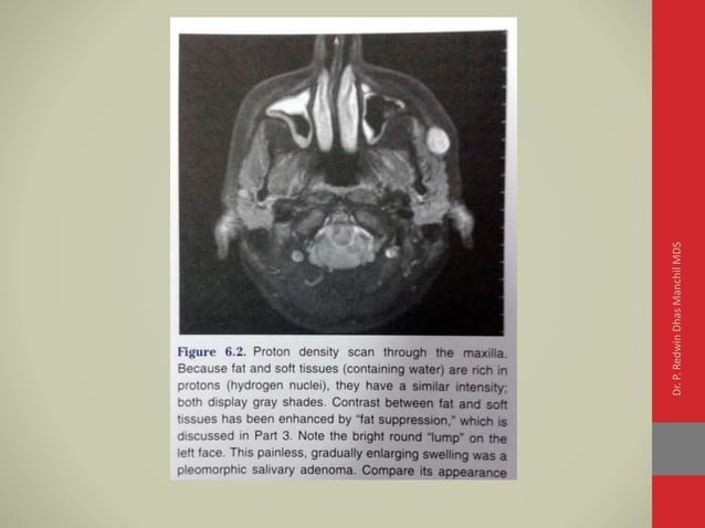 Advanced Imaging - Head and Neck | PPTX