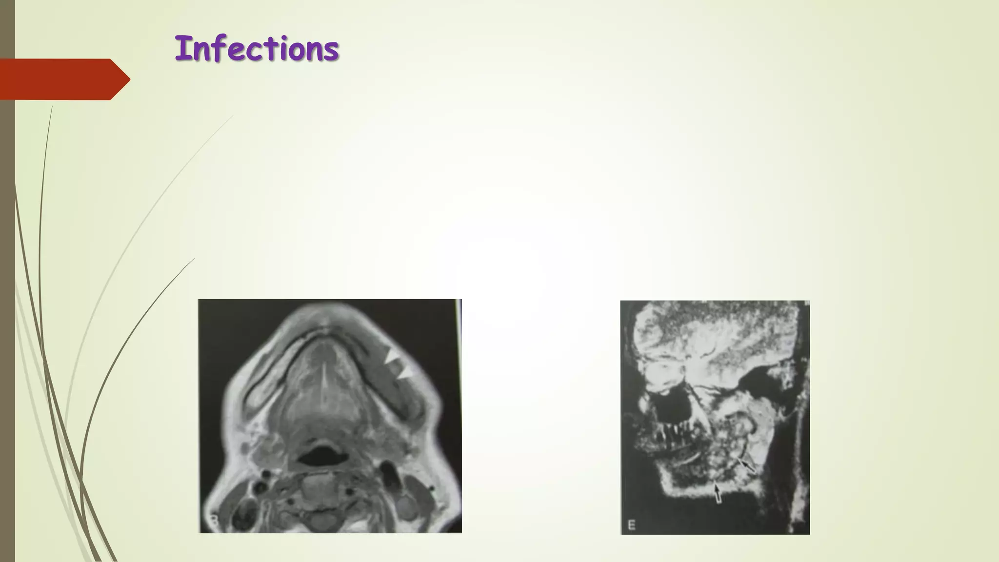 Advanced imaging mri | PPTX