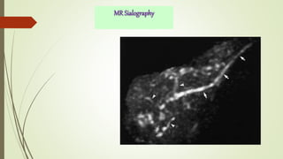 Advanced imaging mri | PPTX